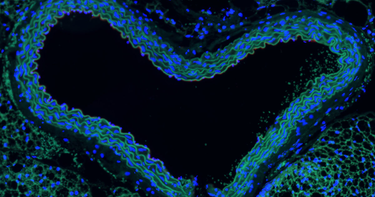 Research and Medical Science • Heart Research Institute
