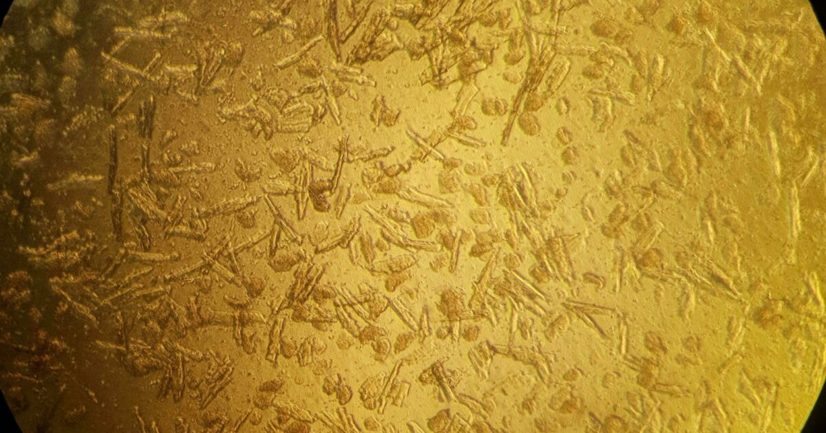 New therapeutic strategies for stiff heart failure • HRI