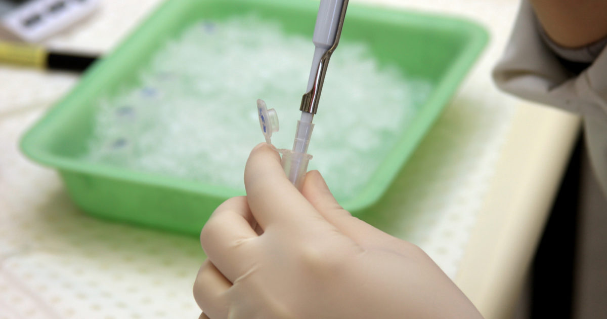 Microvascular Research • Heart Research Institute UK