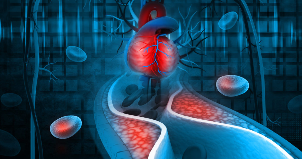High cholesterol • Heart Research Institute UK